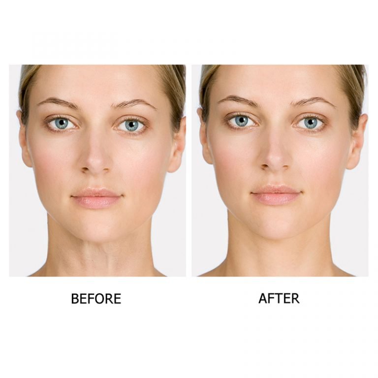 Silicone Care Neck Pad — Luxenmart Up to 80% Off, All For You